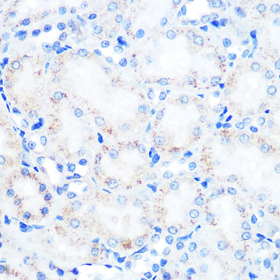 LAMP2 Rabbit mAb-Monoclonal Antibodies - ABclonal