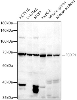 FOXP1 Rabbit pAb-다중클론항체(pAb) - ABclonal