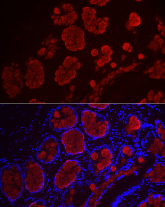 All 세포외 기질 Antibodies Research Areas - ABclonal