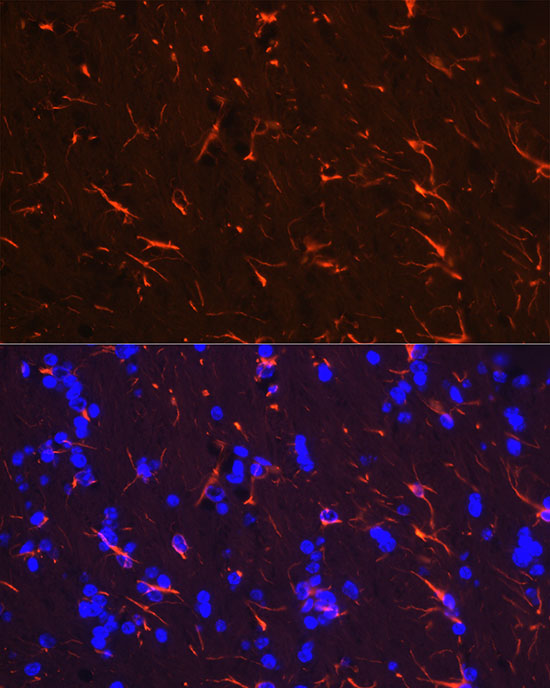 All Cell Type Marker Antibodies Research Areas - ABclonal