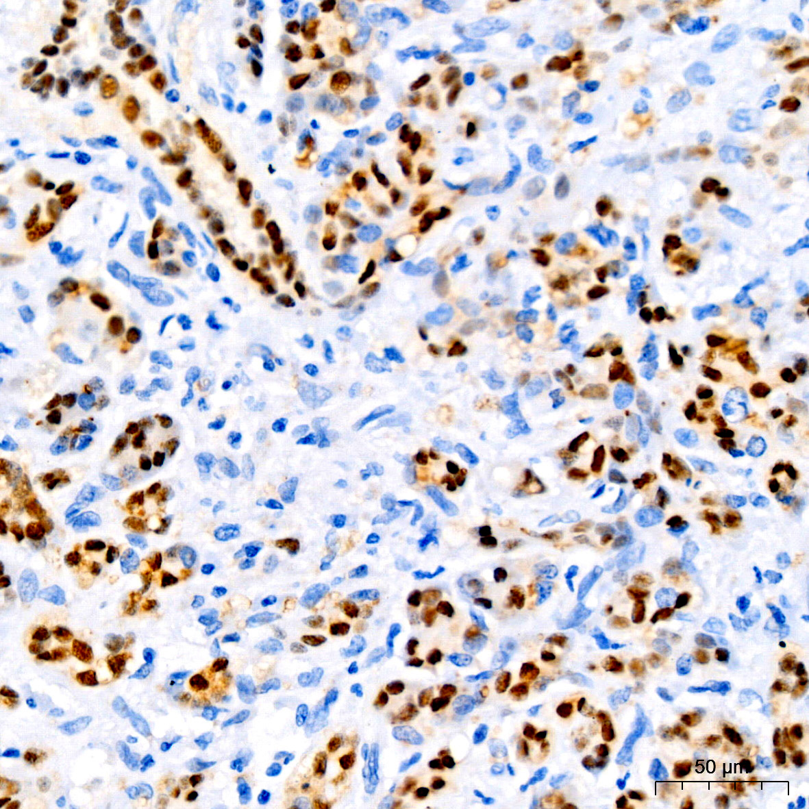 SOX9 Rabbit mAb-Monoclonal Antibodies - ABclonal