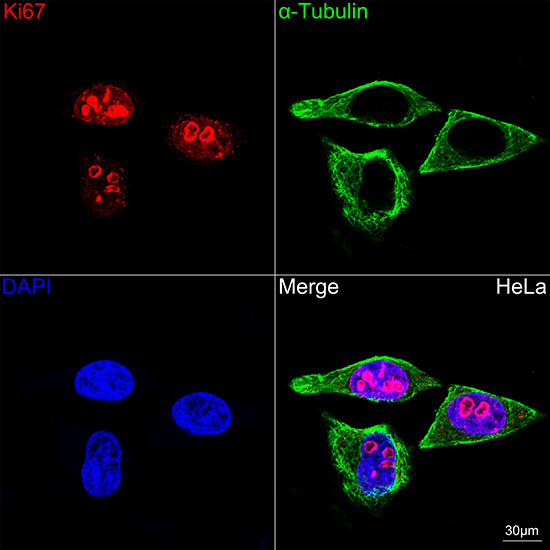 Ki67 Rabbit mAb-단일클론항체(mAb) - ABclonal