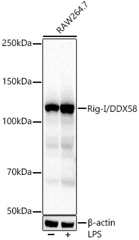 Rig-I/DDX58 Rabbit mAb-Monoclonal Antibodies - ABclonal