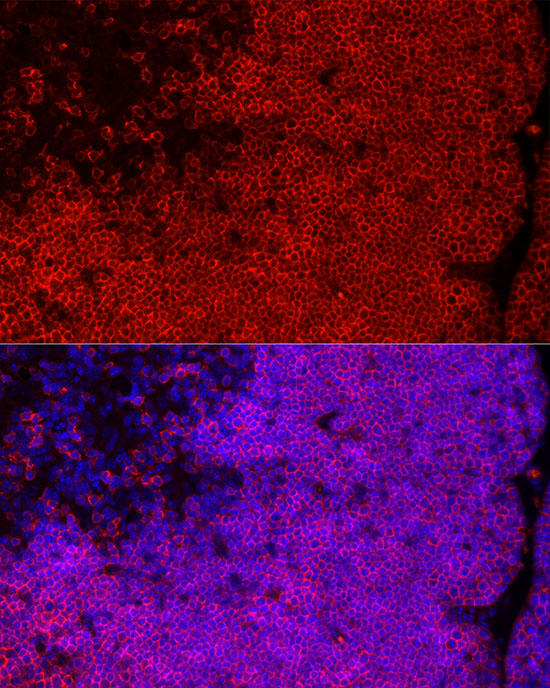 CD8A Rabbit mAb-Monoclonal Antibodies - ABclonal