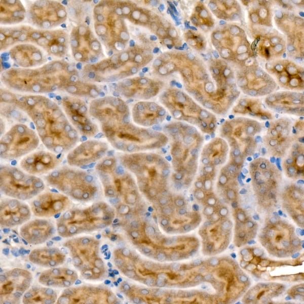 [KO Validated] NF2/Merlin Rabbit mAb-Monoclonal Antibodies - ABclonal