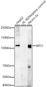 WFS1 Rabbit mAb-Monoclonal Antibodies - ABclonal