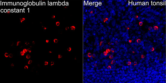 Human Lambda Light Chain Rabbit mAb-단일클론항체(mAb) - ABclonal