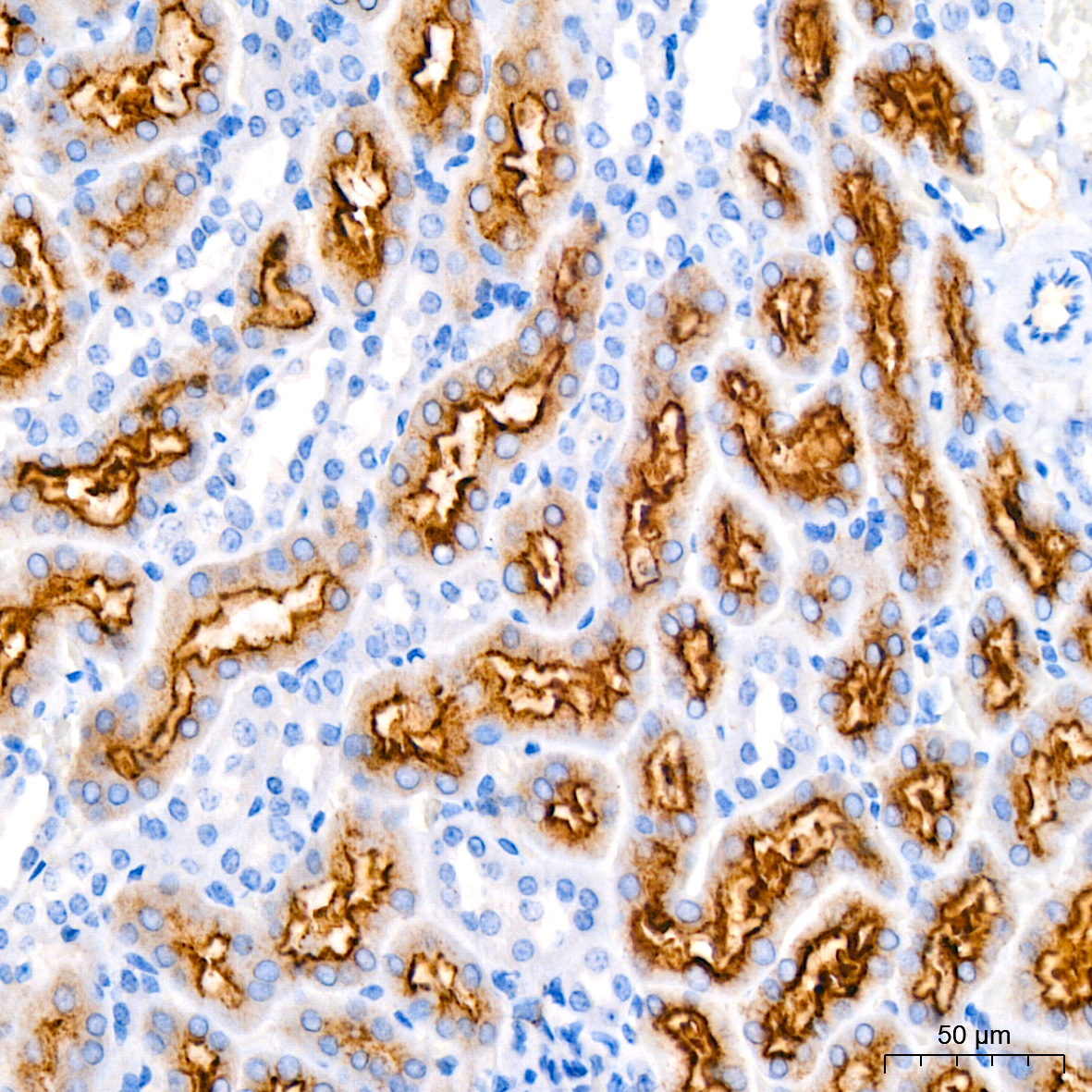 Megalin/LRP2 Rabbit mAb-Monoclonal Antibodies - ABclonal