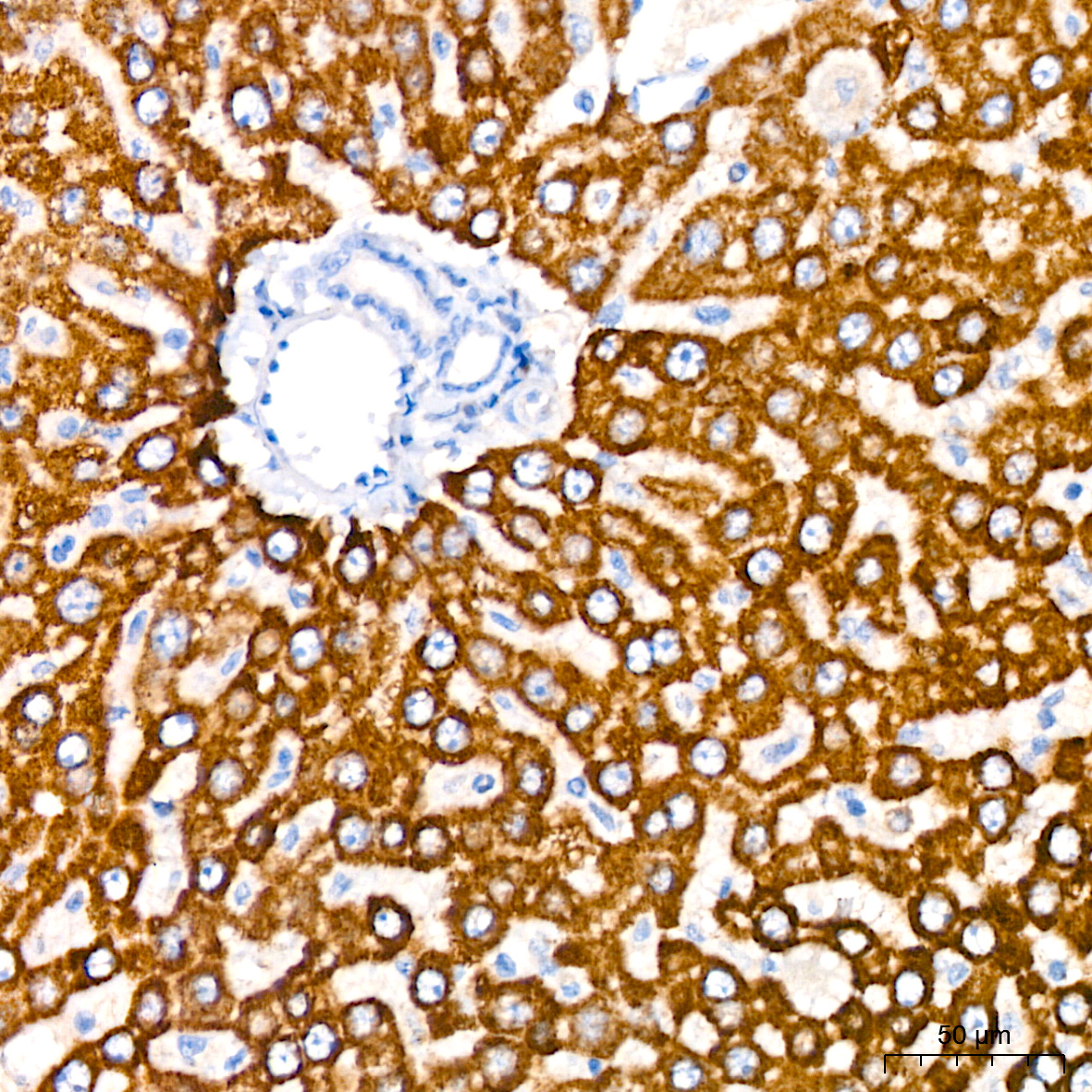 Megalin/LRP2 Rabbit mAb-Monoclonal Antibodies - ABclonal