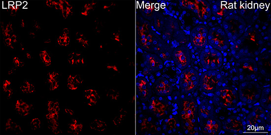 Megalin/LRP2 Rabbit mAb-Monoclonal Antibodies - ABclonal