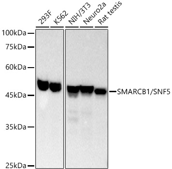 [KO Validated] SMARCB1/SNF5 Rabbit mAb-단일클론항체(mAb) - [30% 할인중] - ABclonal