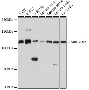 MIB1/DIP1 Rabbit mAb-Monoclonal Antibodies - ABclonal