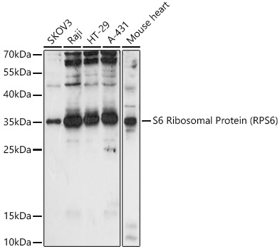 All Akt downstream targets Antibodies Research Areas - ABclonal