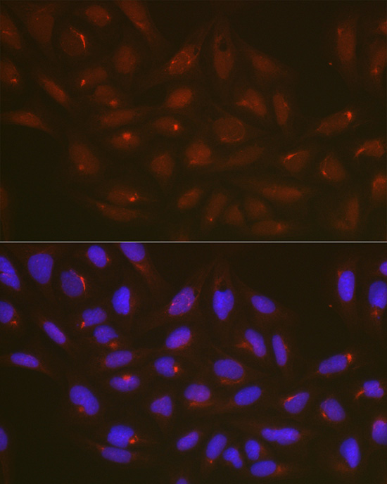 ATG14 Rabbit pAb-Polyclonal Antibodies - ABclonal