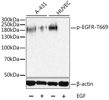 Phospho-EGFR-Y845 Rabbit pAb-Phospho-specific Antibodies - ABclonal