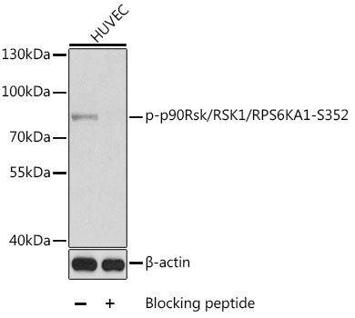 Phospho-p90Rsk/RSK1/RPS6KA1-S352 Rabbit pAb-Phospho-specific Antibodies ...