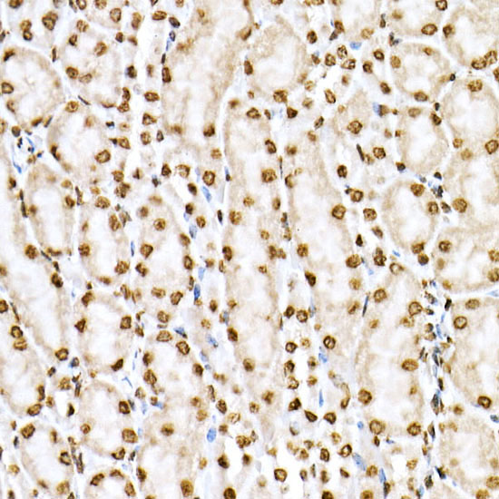 Phospho-STAT6-Y641 Rabbit pAb-인산화 특이적 항체 - ABclonal