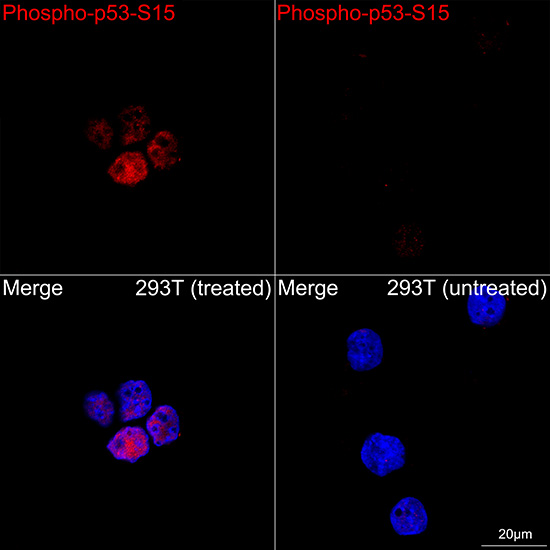 Phospho-p53-S15 Rabbit mAb-인산화 특이적 항체 - ABclonal