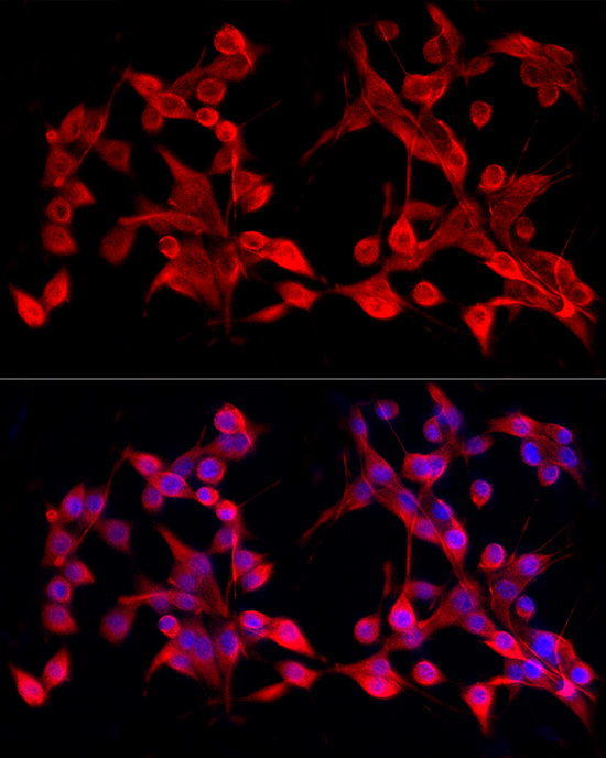 ABflo® 594-conjugated Goat Anti-Rabbit IgG (H+L)-Secondary Antibodies ...