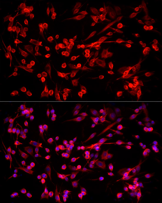 ABflo® 594-conjugated Goat Anti-Rabbit IgG (H+L)-Secondary Antibodies ...